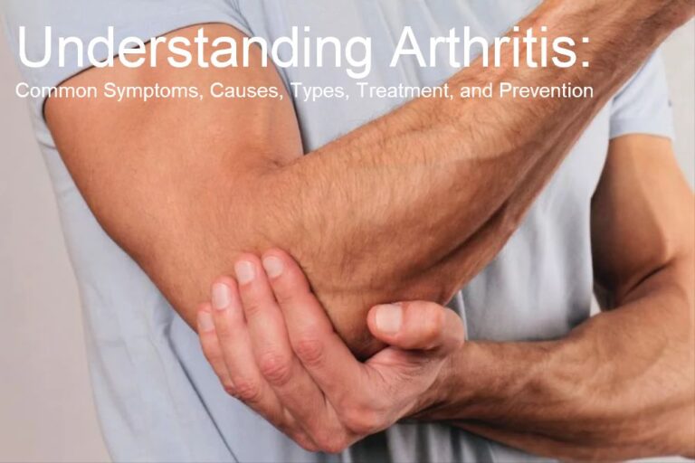 Understanding Arthritis: Common Symptoms, Causes & Treatment